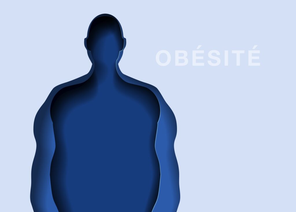 Tout Savoir Sur L’Obésité – Problème D’Obésité – SQMKS