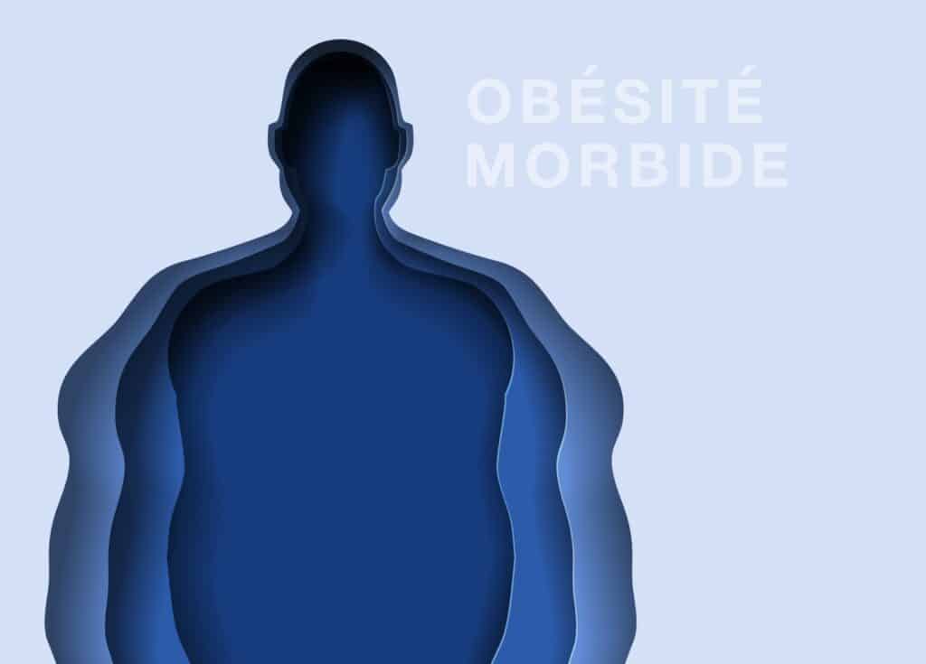 Obésité morbide : causes et traitements | IOPC | Paris